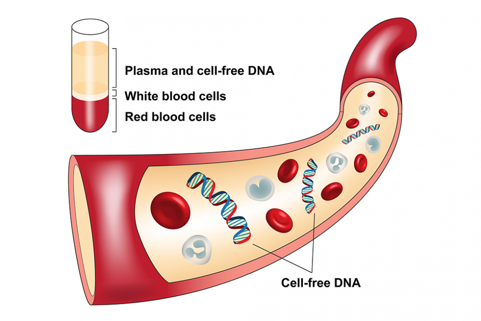 Generic cfDNA Quantification - DiaCarta, Inc.